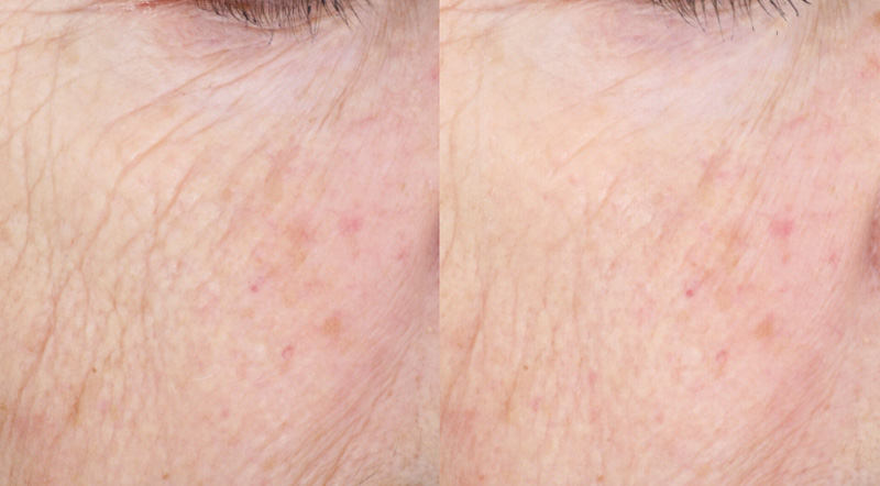 Anti-Aging Test - Home